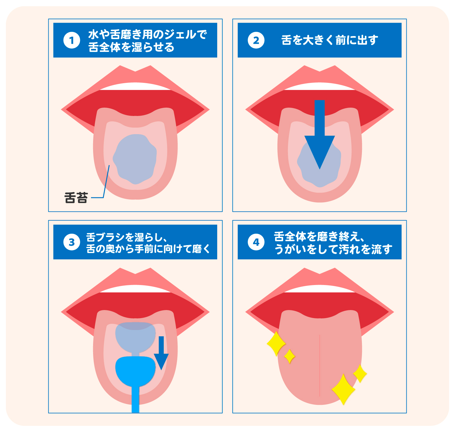 女性の口臭は何が原因？改善に導く口臭対策（ケア方法）を徹底解説！｜wakanote