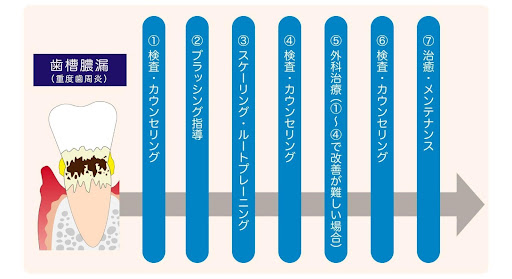 歯槽膿漏（歯周病）とは？原因や歯肉炎との症状の違い・治療方法を解説！｜wakanote