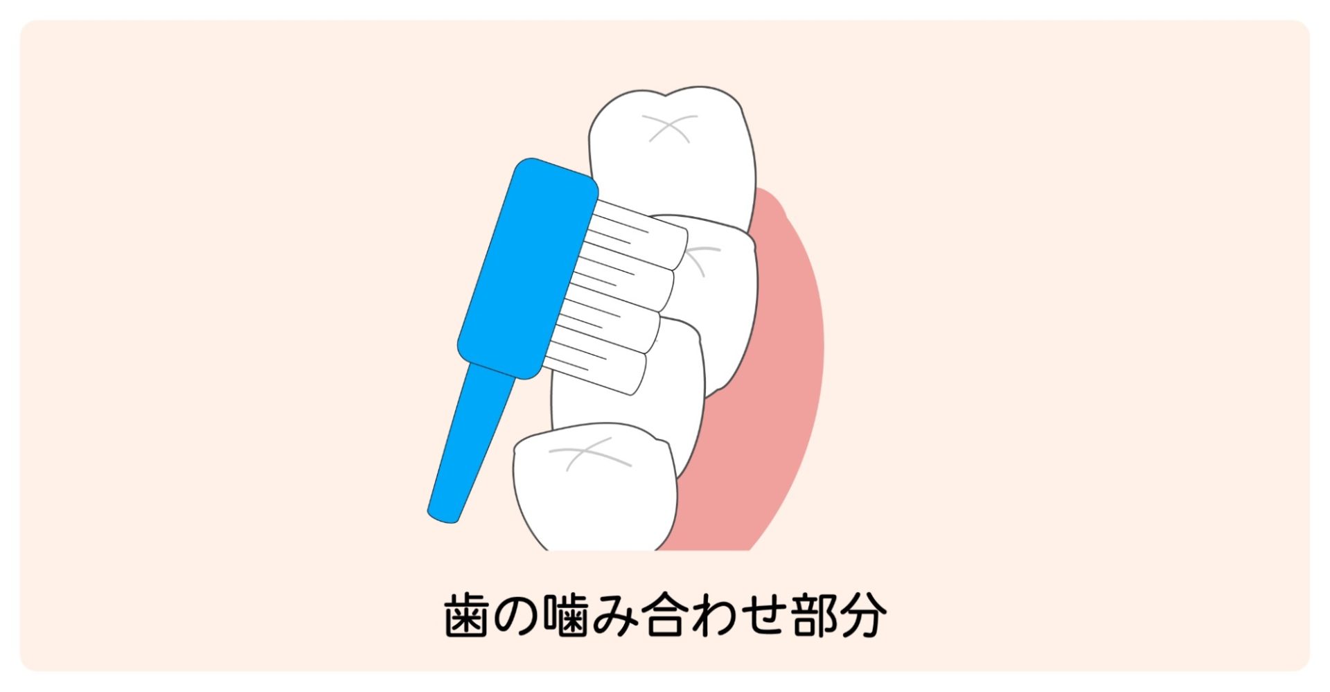 【歯茎の腫れ】歯茎が腫れる原因や考えられる病気は？セルフケア方法も紹介｜wakanote